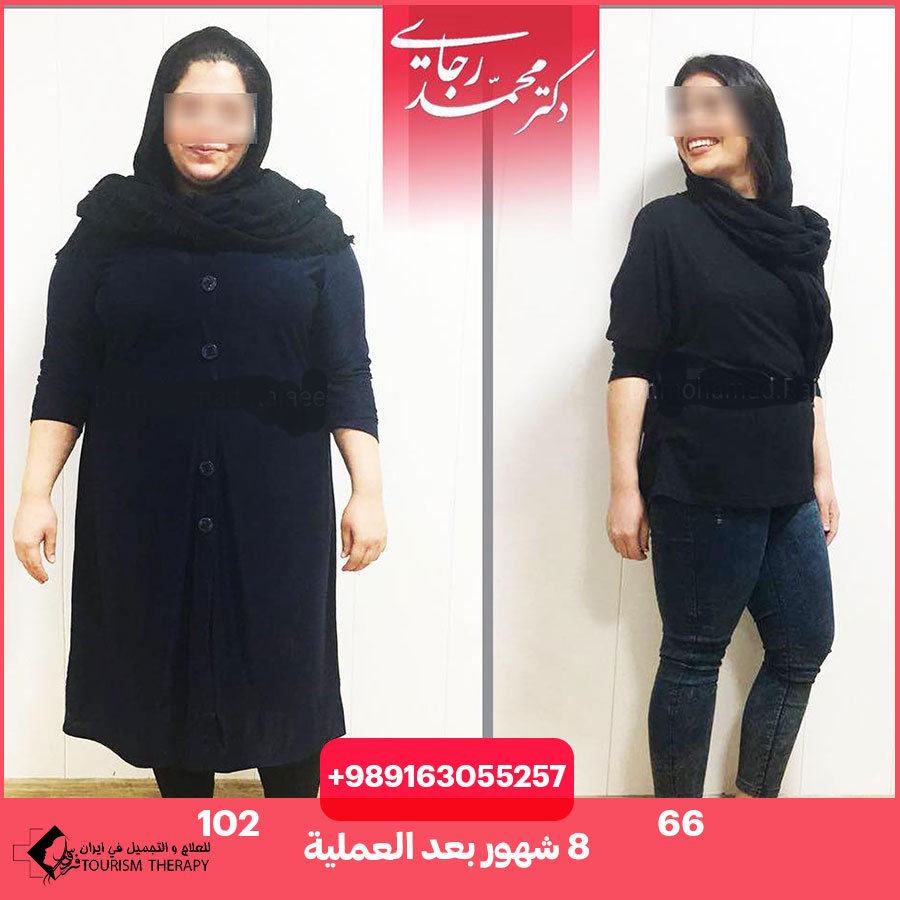 المواصفات والسعر وحجز موعد تحويل مسار المعدة المصغر في شيراز | الدكتور ...