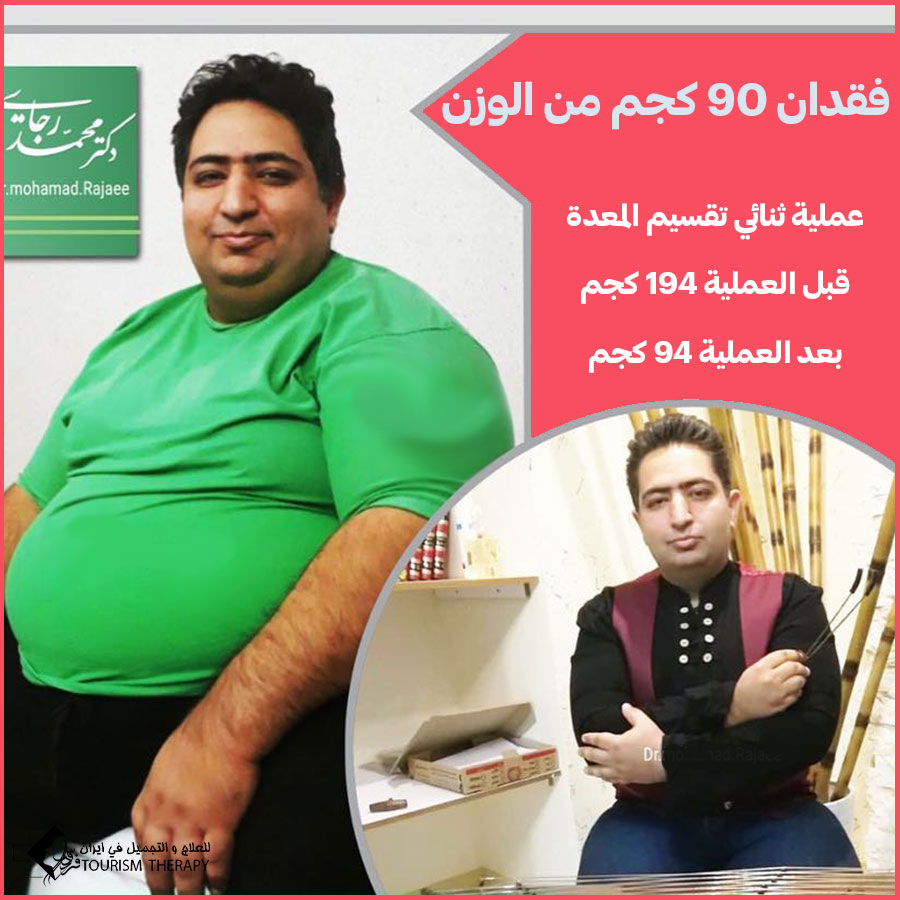 المواصفات والسعر وشراء ثنائي تقسيم المعدة في شيراز | الدكتور محمد رجايي